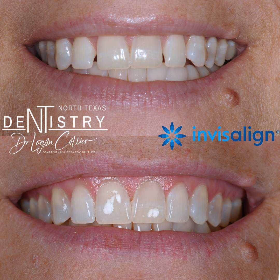 Our Gallery - Best Dentist in Garland, TX