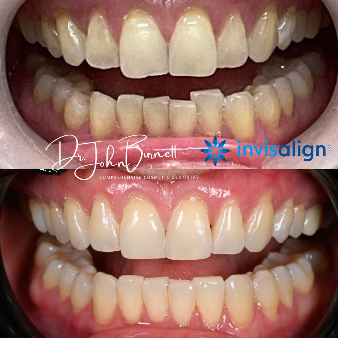 Our Gallery - Best Dentist in Garland, TX