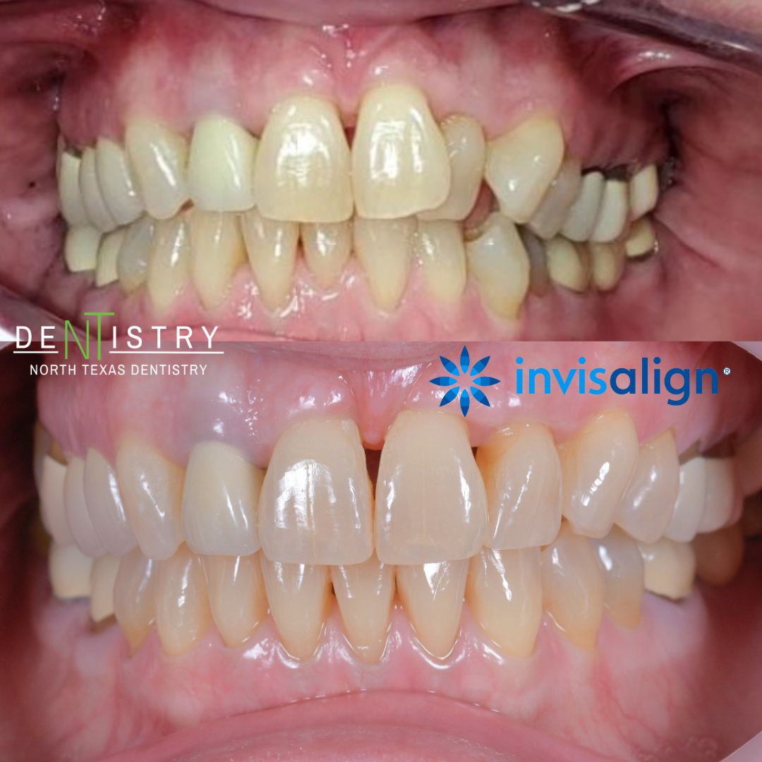 Our Gallery - Best Dentist in Garland, TX